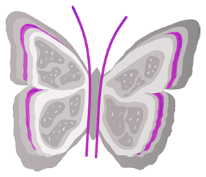 CAR T in autoimmune diseases